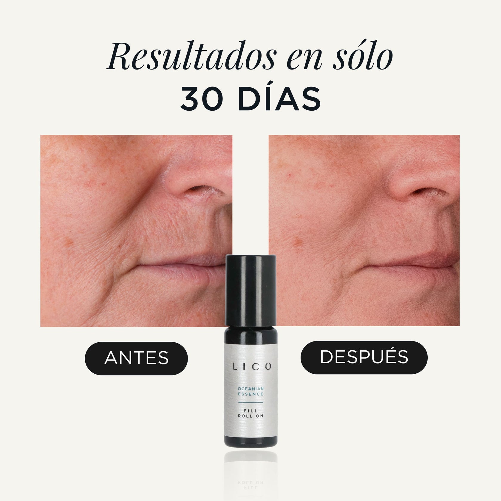 Fill Roll On - Rellena arrugas profundas del surco nasogeniano – LICO ...